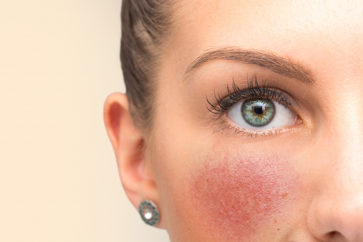 YOUR SKIN – Eptaderm